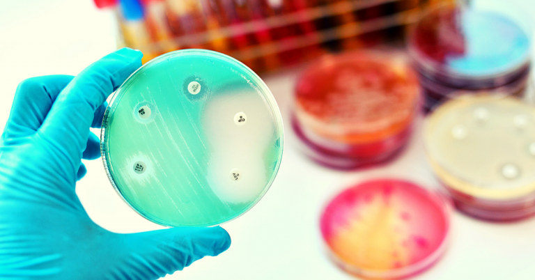 Antimicrobial Resistance (AMR) in the food chain – Food Standards Agency